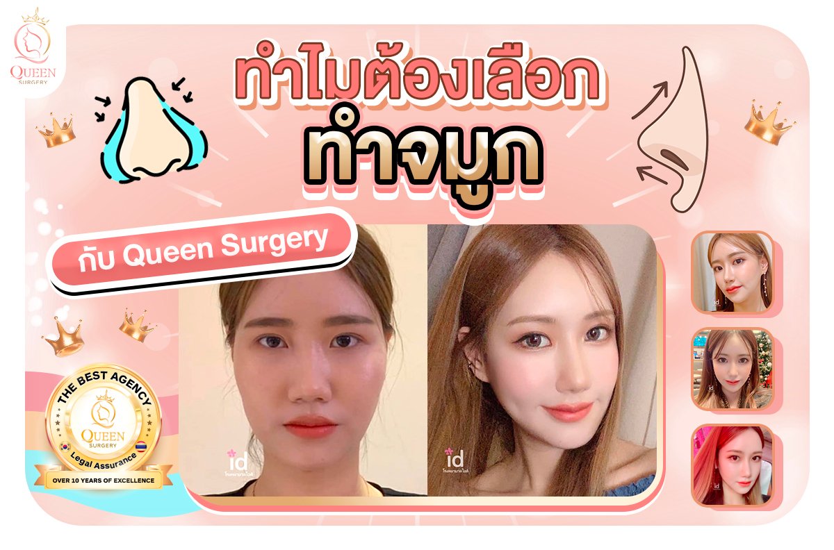 ทำไมต้องเลือก ทำจมูก กับ Queen Surgery